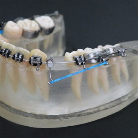 Teardrop Loop Spring Test Specimen Download Scientific Diagram