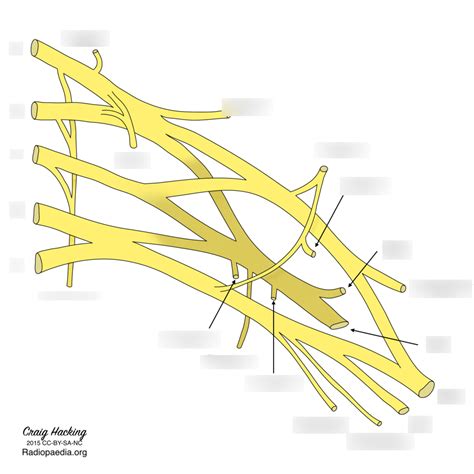 Brachial Plexus Diagram Quizlet