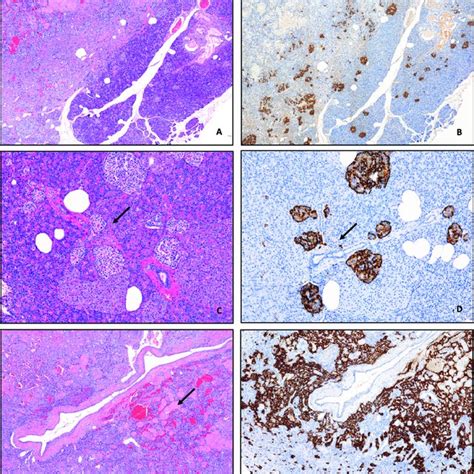 Mean Sensor Glucose Levels Over 12 Days Of Continuous Subcutaneous