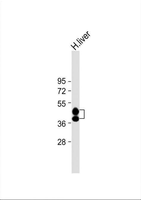 Hp Antibody Cat No 63 707 Prosci