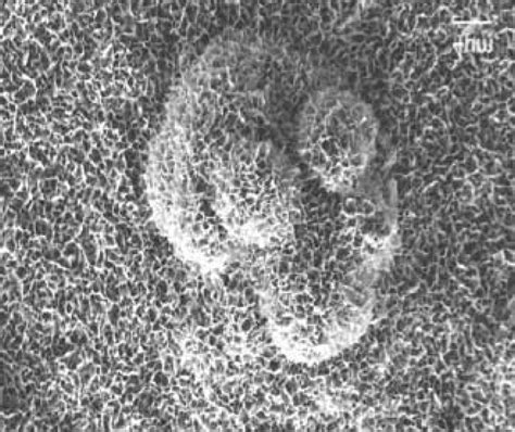 Vật Liệu Tái Tạo Cùi Răng Sinh Học Predicta™ Bioactive Core Build Up