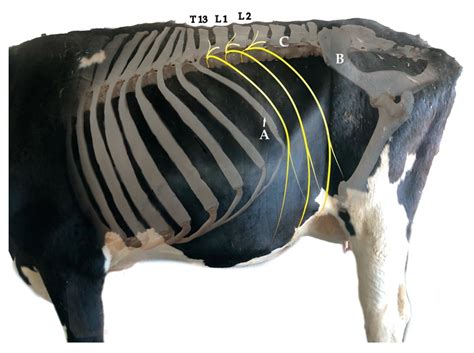 Description Of An Ultrasound Guided Erector Spinae Plane Block And