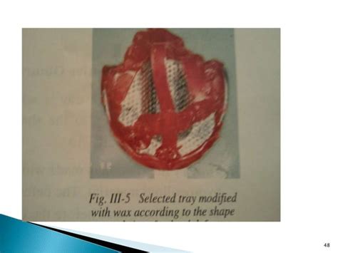 Acquired Maxillary Defects Copy Removeable Ppt