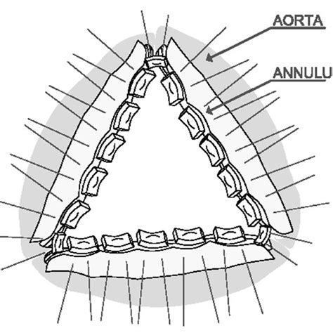 Classic Technique Of AVR Download Scientific Diagram
