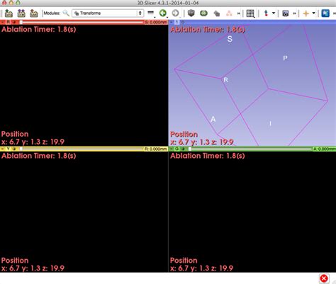 Documentationnightlymodulescornerannotation Slicer Wiki