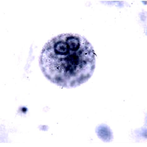 Dientamoeba Fragilis Troph