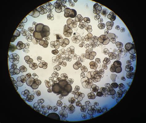 Microfossil Of The Month Globigerina Ooze