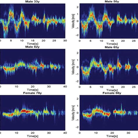 Radar Spectrograms In Normalised Log Scale For The Same Sequence Of 6 Download Scientific