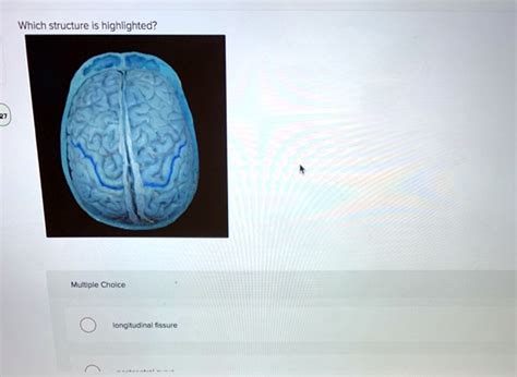 solved which structure is highlighted multiple choice longitudinal