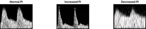 Benefits Of Tcd Ultrasound Neurasignal Academy