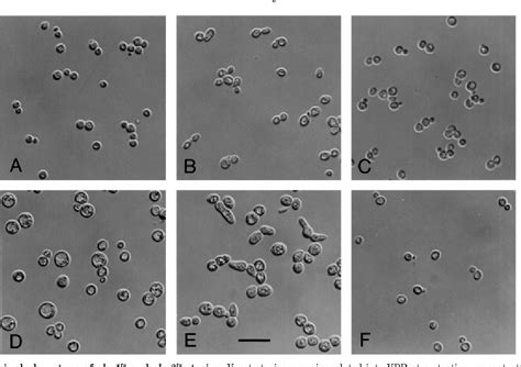 Figure 3 From Temperature Sensitive Mutations Of The Cka1 Gene Reveal A Role For Casein Kinase