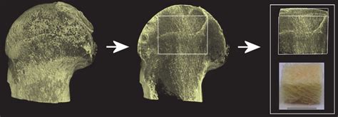 3d Reconstruction Of One Of The Human Femoral Bone Samples Showing The