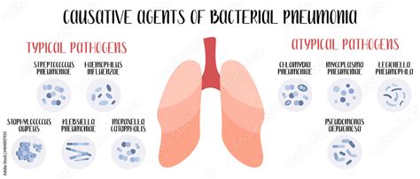 Causative Agents Of Bacterial Pneumonia Acute Respiratory Tract