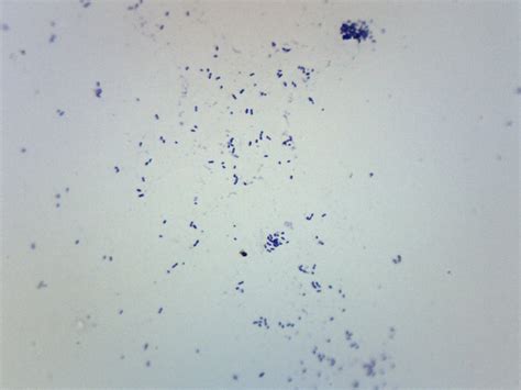 Streptococcus Pneumoniae Gram Pos Prepared Microscope Slide 75x — Eisco Labs