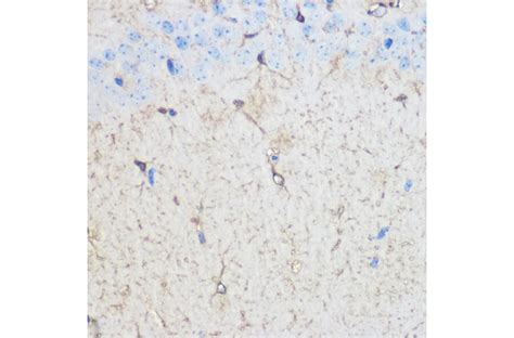 Anti S100 Beta Antibody A17137