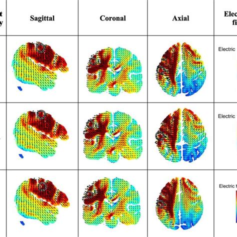 Electrical Fields Of Cathodal Transcranial Direct Current Stimulation Download Scientific