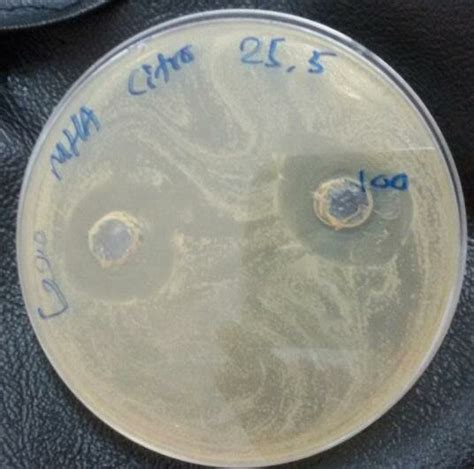 Left And Right Show Inhibition Zone Of Pyocyanin 75 And 100 Download Scientific Diagram