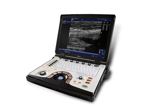 Elevate Your Medical Practice With Logiq S7 Ultrasound System