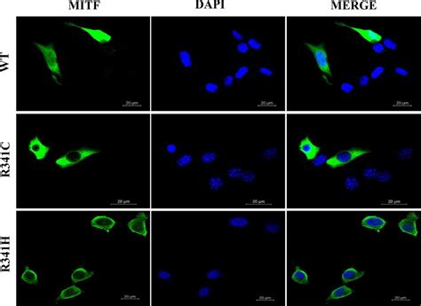 subcellular localization of wild type and mutant mitf proteins the
