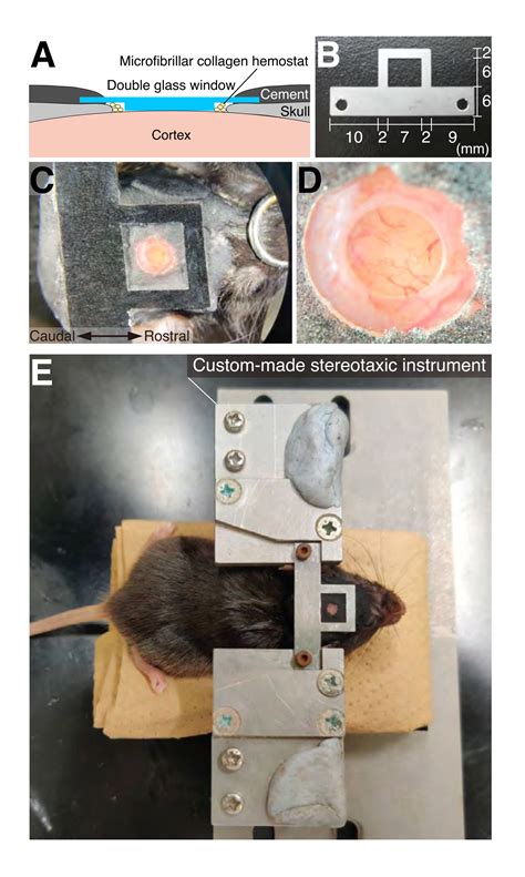 Simultaneous Imaging Of Microglial Dynamics And Neuronal Activity In Awake Mice