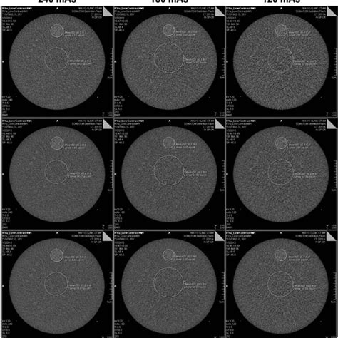 Noise Power Spectrum Analysis Of Two Commercial Reconstruction Kernels Download Scientific