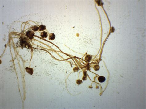 Rhizopus Stolonifer Under Microscope