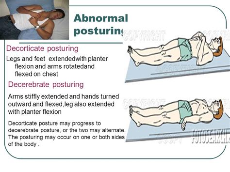 Assessment Of The Nervous System 230 Nurs Ppt Download