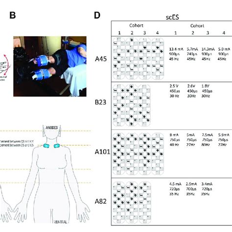 Combined Neuromodulation Set Up And Stimulation Parameters A Download Scientific Diagram