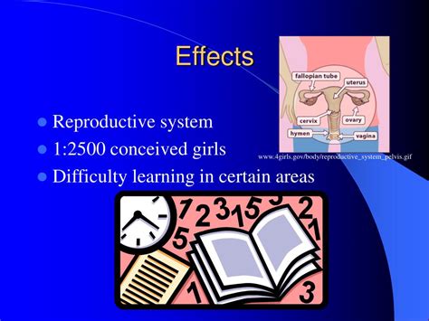 Ppt Turner Syndrome Powerpoint Presentation Free Download Id4891235