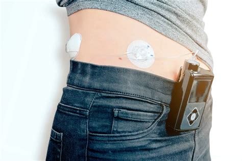 The Closed Loop System For Diabetes Kaio Dia