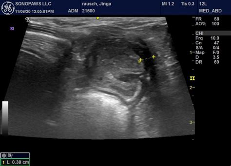 Intussusception Members