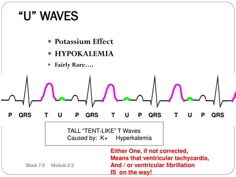 Ppt Adult Health Nursing Ii Block 70 Powerpoint Presentation Free