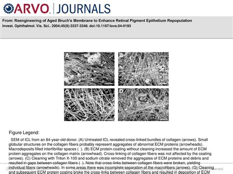 Invest Ophthalmol Vis Sci 459 Doi Iovs Figure Legend Ppt