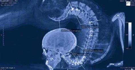 13 Of The Most Unusual X Ray Pictures Ever