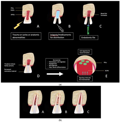 Ijms Free Full Text Tissue Characteristics In Endodontic Regeneration A Systematic Review