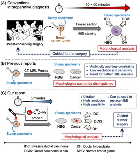 Tumor Detection During Breast Cancer Surgery It Ain T Magic