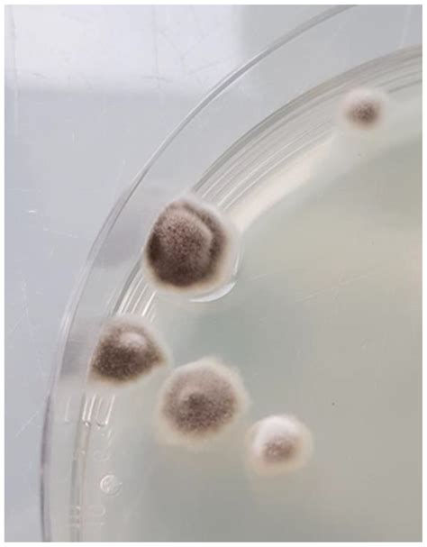 Recurrent Subcutaneous Phaeohyphomycosis Due To Medicopsis Romeroi A