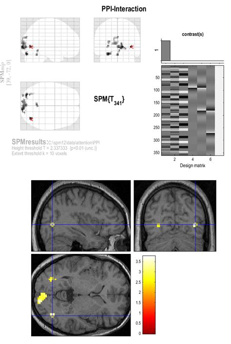 Psychophysiological Interactions Ppi Spm Documentation