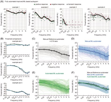 comparison of air‐conduction audiometry measures using three different