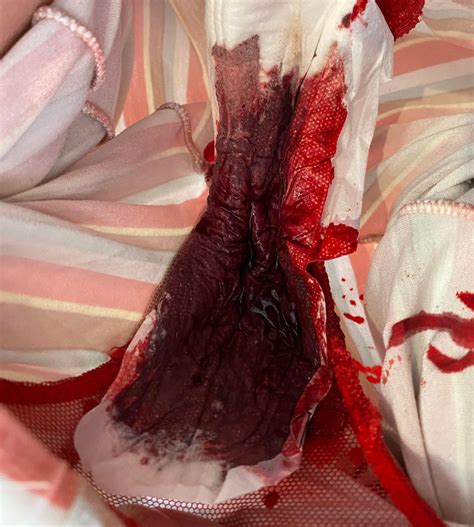 Is This Amount Of Blood Normal I Think This Is My Heaviest Period Ever