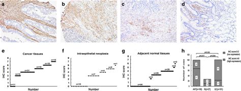 versican expression as assessed by immunohistochemistry in cancerous