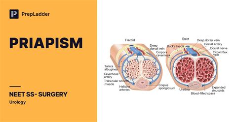 Understanding Priapism Causes Symptoms And Treatment Options