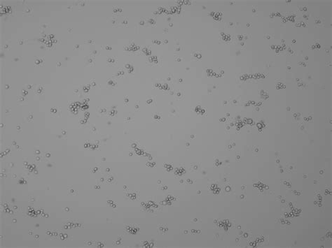 Dalia Roboflow Universe