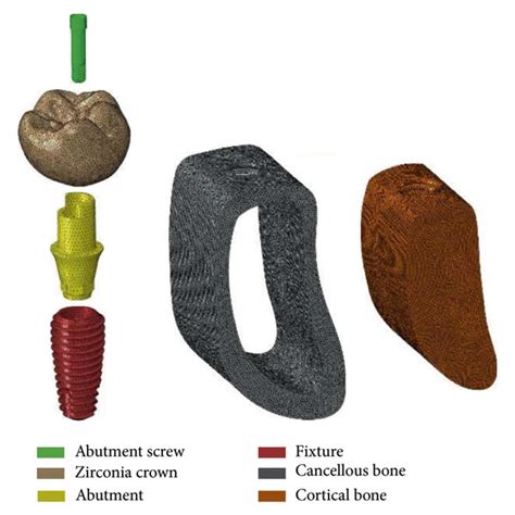 Finite Element Models Of Implant Components And Bone Block Element