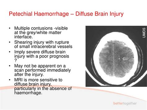 Ppt Ct For Adis Module Powerpoint Presentation Free Download Id