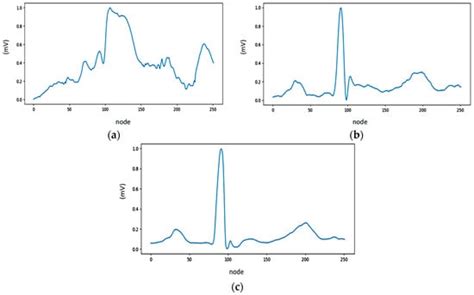 Deep Learning Based Stacked Denoising And Autoencoder For Ecg Heartbeat Classification