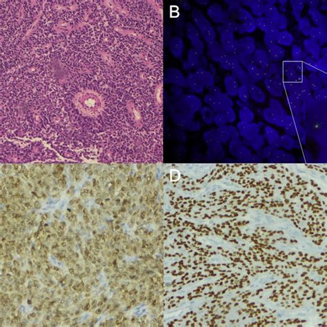 Histopathology Related Images A He Staining Shows That The Small Download Scientific Diagram