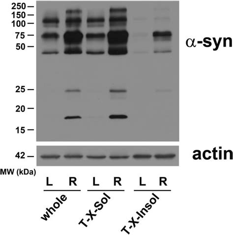 Mhcii Is Required For α Synuclein Induced Activation Of Microglia Cd4 T Cell Proliferation And