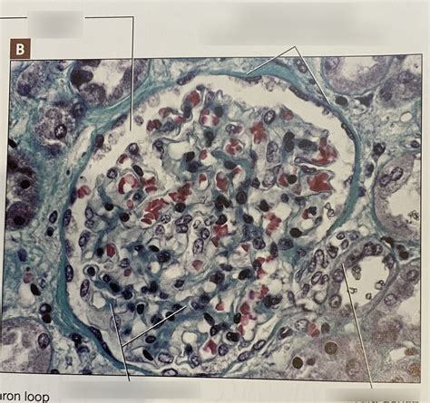 Glomerulus Histology Diagram Quizlet