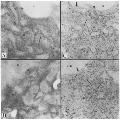 Blocking Experiment Using Electron Microscopic Immunocytochemical